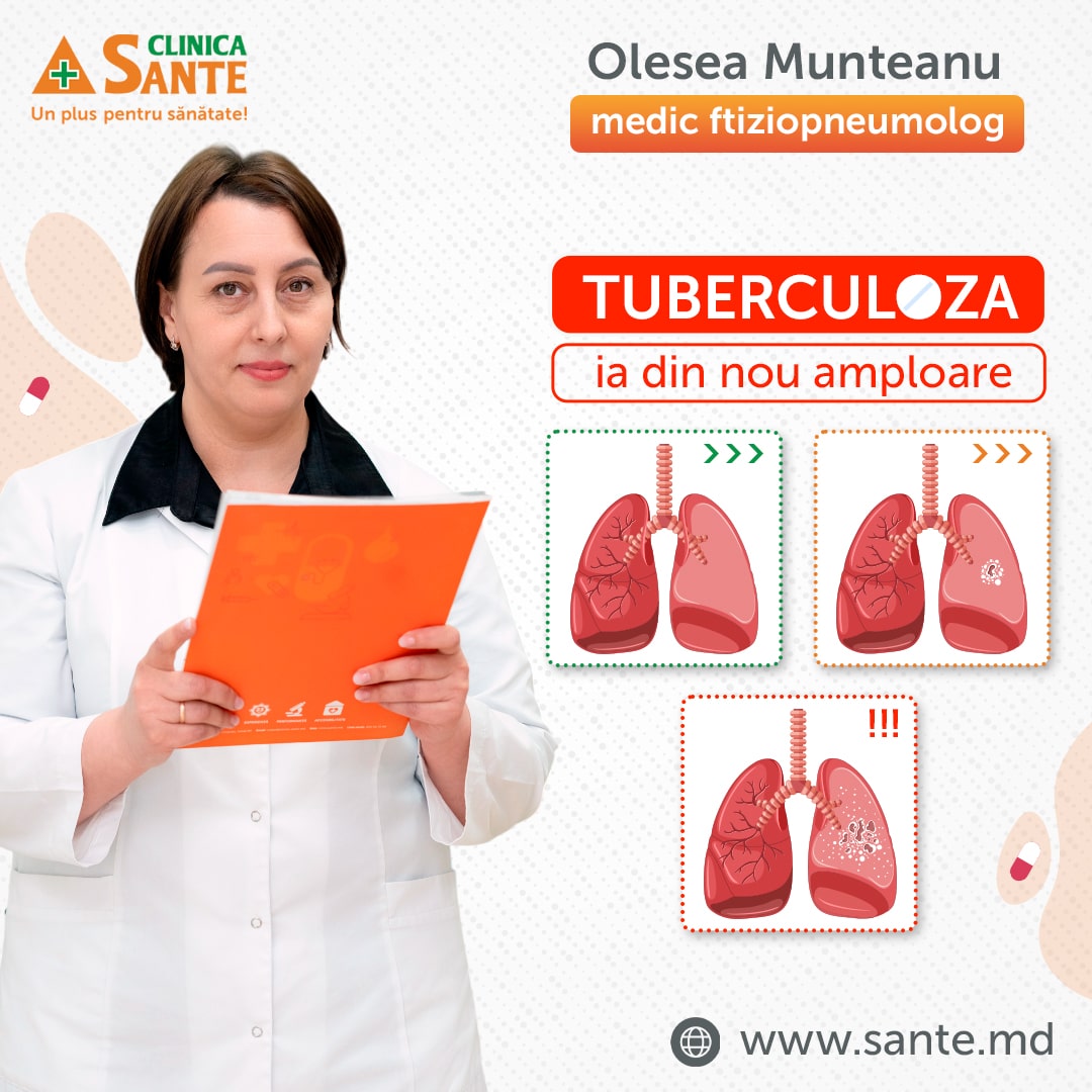 Tuberculoza: soluții moderne de diagnostic și tratament - Clinica Sante