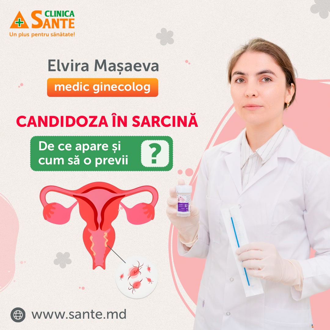 Candidoza în sarcină: cauze, simptome și tratament sigur | Clinica Sante